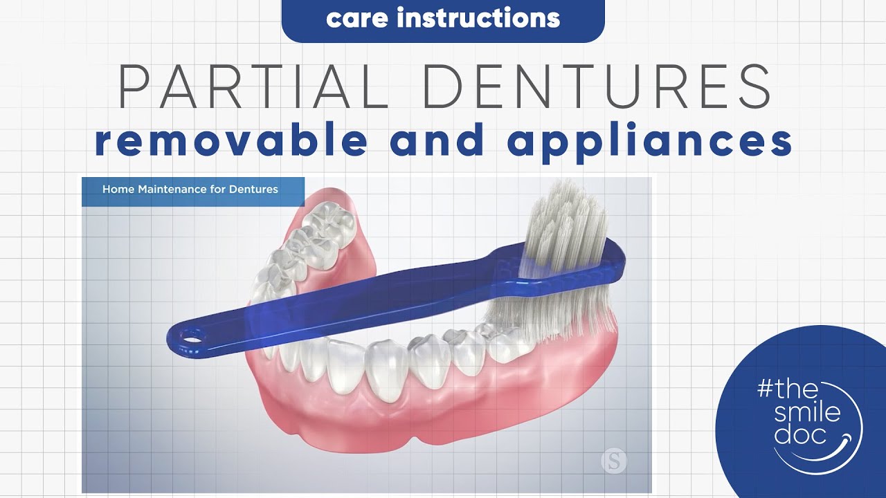 Care Instructions: Partial Dentures - Removable and Appliances