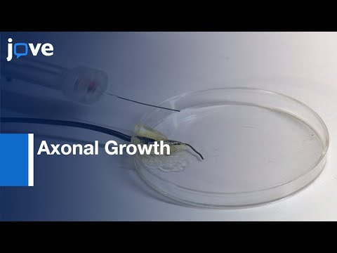 Axonal Growth Patterns and Morphology Study by Olfactory System | Protocol Preview