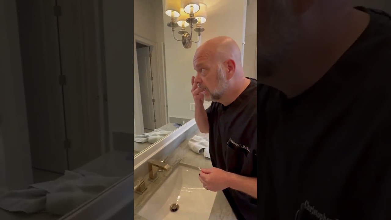 How to put ointment in your eye