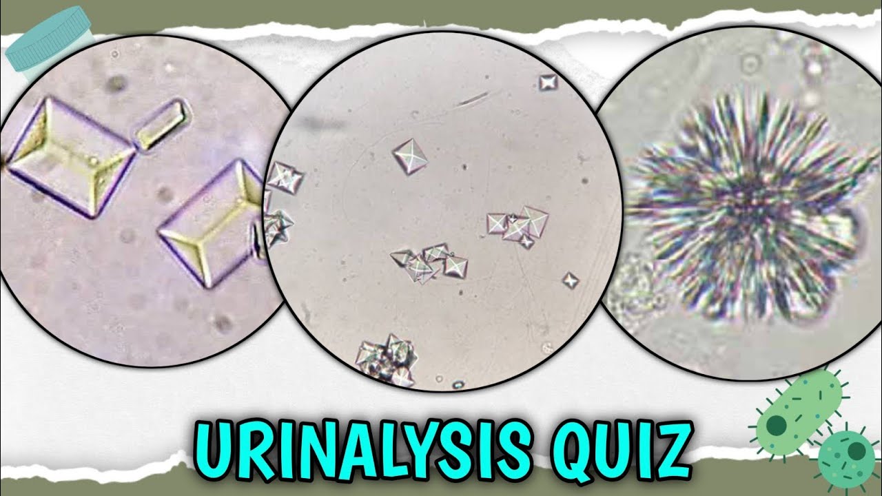Urine Crystals Identification Quiz | AUBF