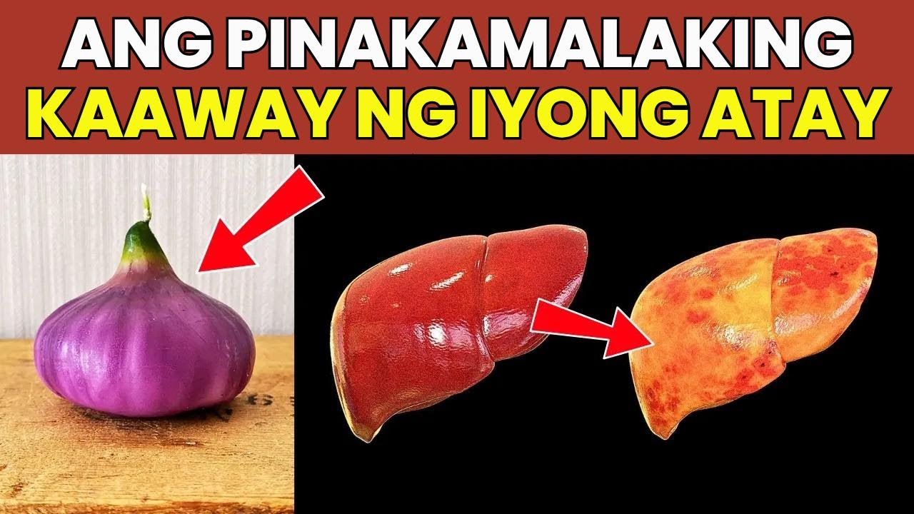 Tahimik na Panganib: Mga Pagkaing Nakakasama sa Atay at Paano Ito ...