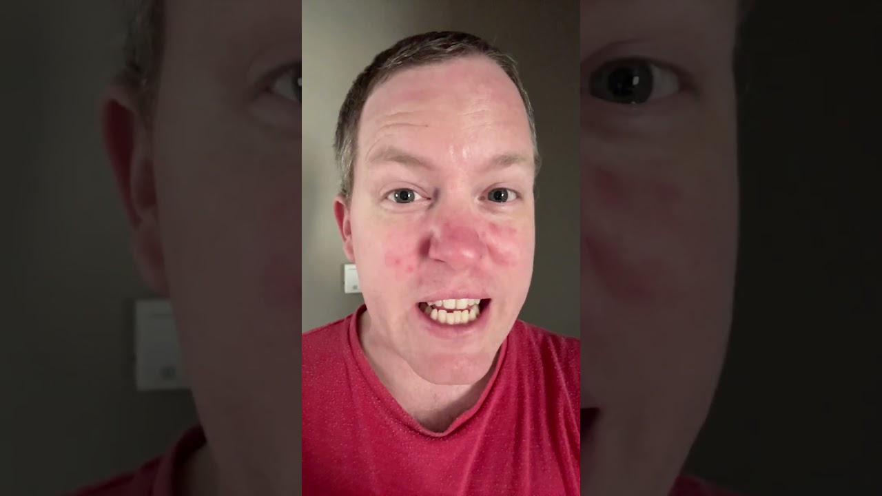 $210K Recovered After AI Crypto Withdrawal Scam | Steve’s Story