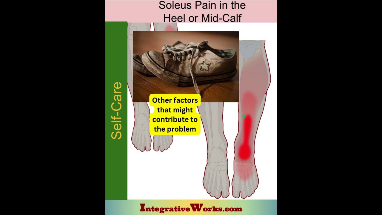 Soleus - Trigger point heel pain