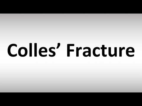 How to Pronounce Colles Fracture