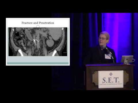 Troublesome Trends in IVC Filter Use & Late Failure