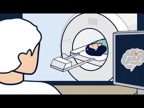 Laser Ablation (LITT) for Brain Tumors