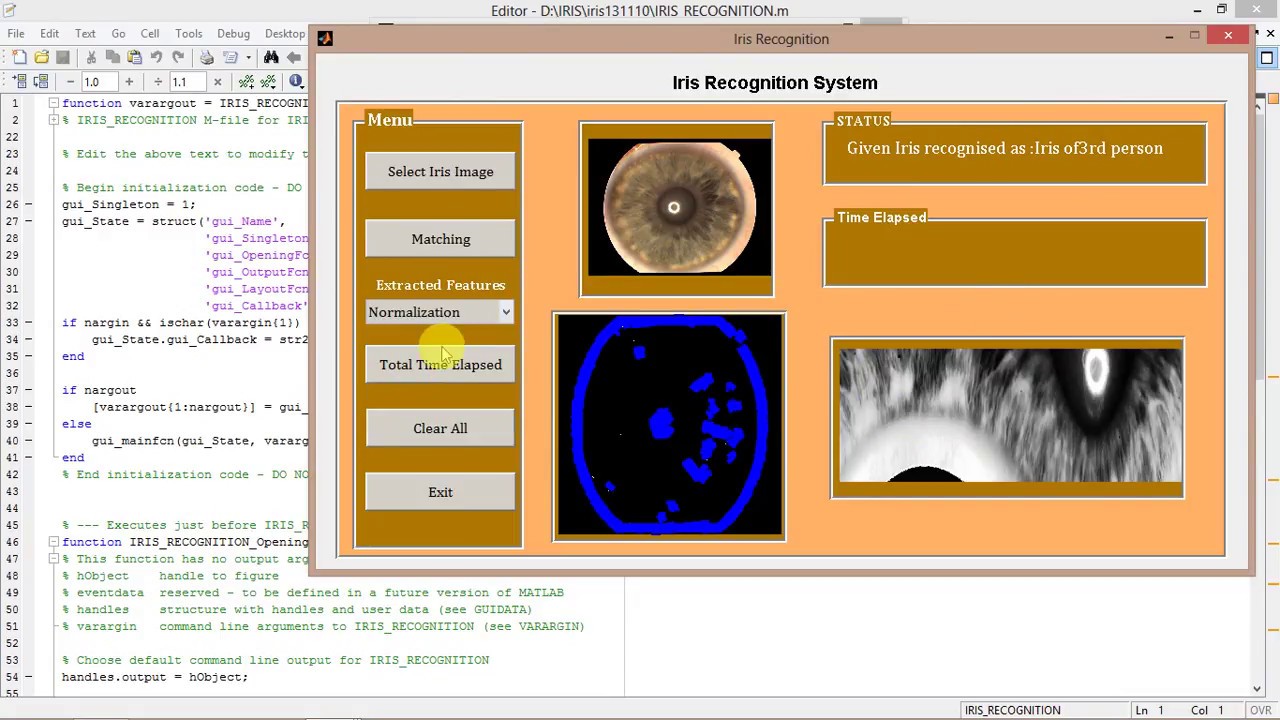 Iris Recognition System Using Matlab Project Source Code | Iris Recognition Using Image Processing