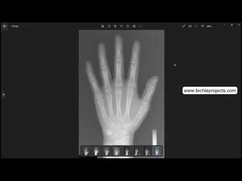 Hand Bone Joint Detection using Image Processing | Python Project Fracture Detection