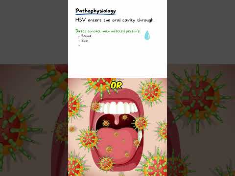 How Herpes Infects The Oral Cavity | Herpes Simplex Virus