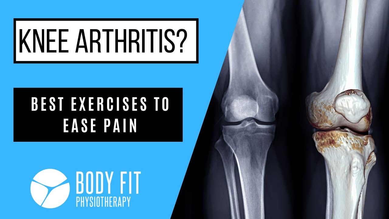 Knee Arthritis Exercises That Actually Work | Hydrotherapy, Step-Ups & Sit-to-Stands