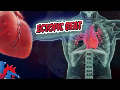 Ectopic beat - Human Heart ❤️ and Cardiology ❤️🔊✅