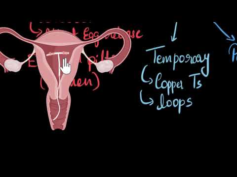 Contraceptives (mechanical barriers, hormonal, surgical) (video) | Khan ...