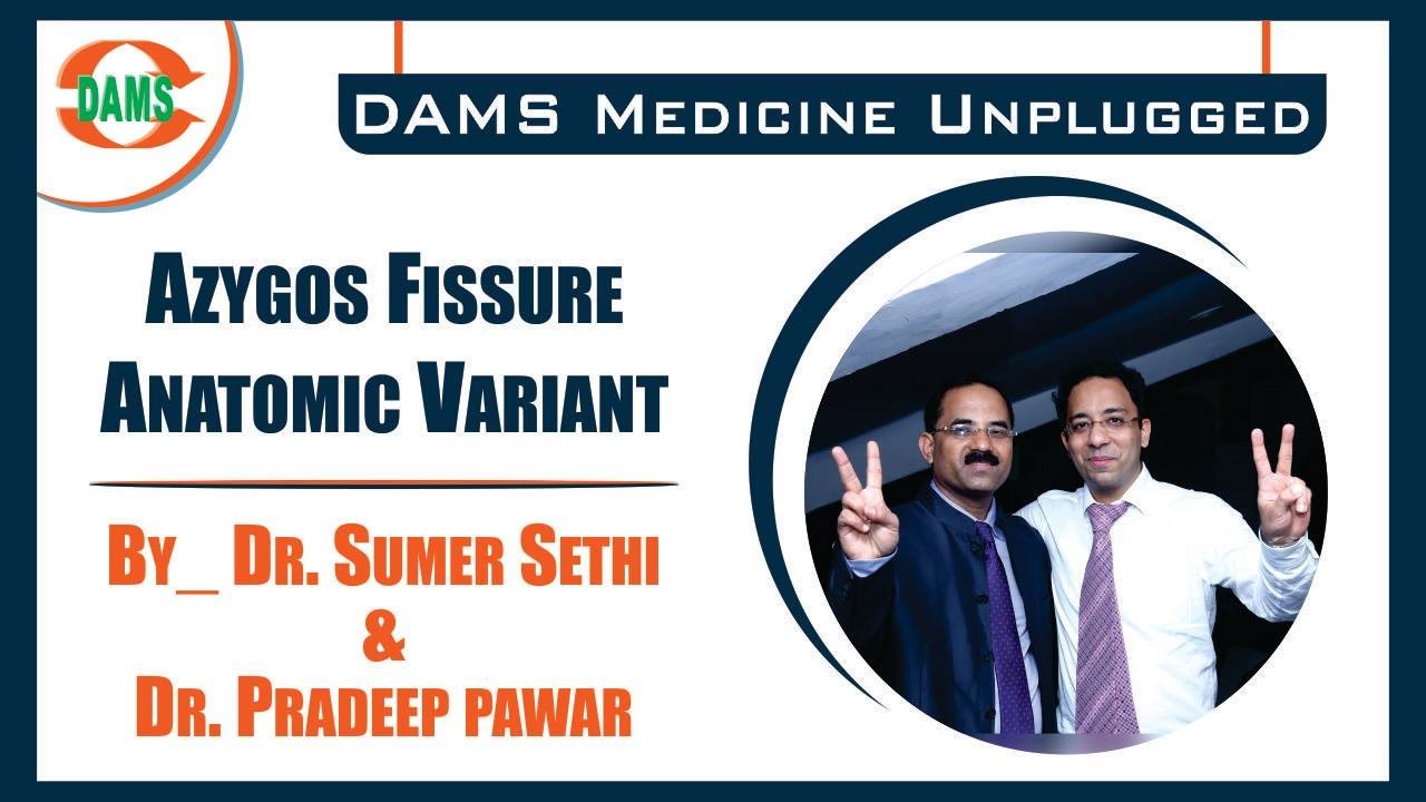 Azygos Fissure Anatomic Variant :- DAMS Medicine Unplugged