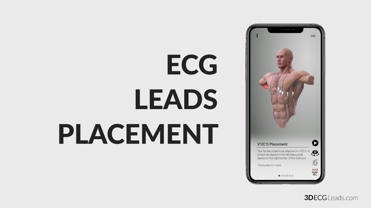 12 lead ECG lead placement - App