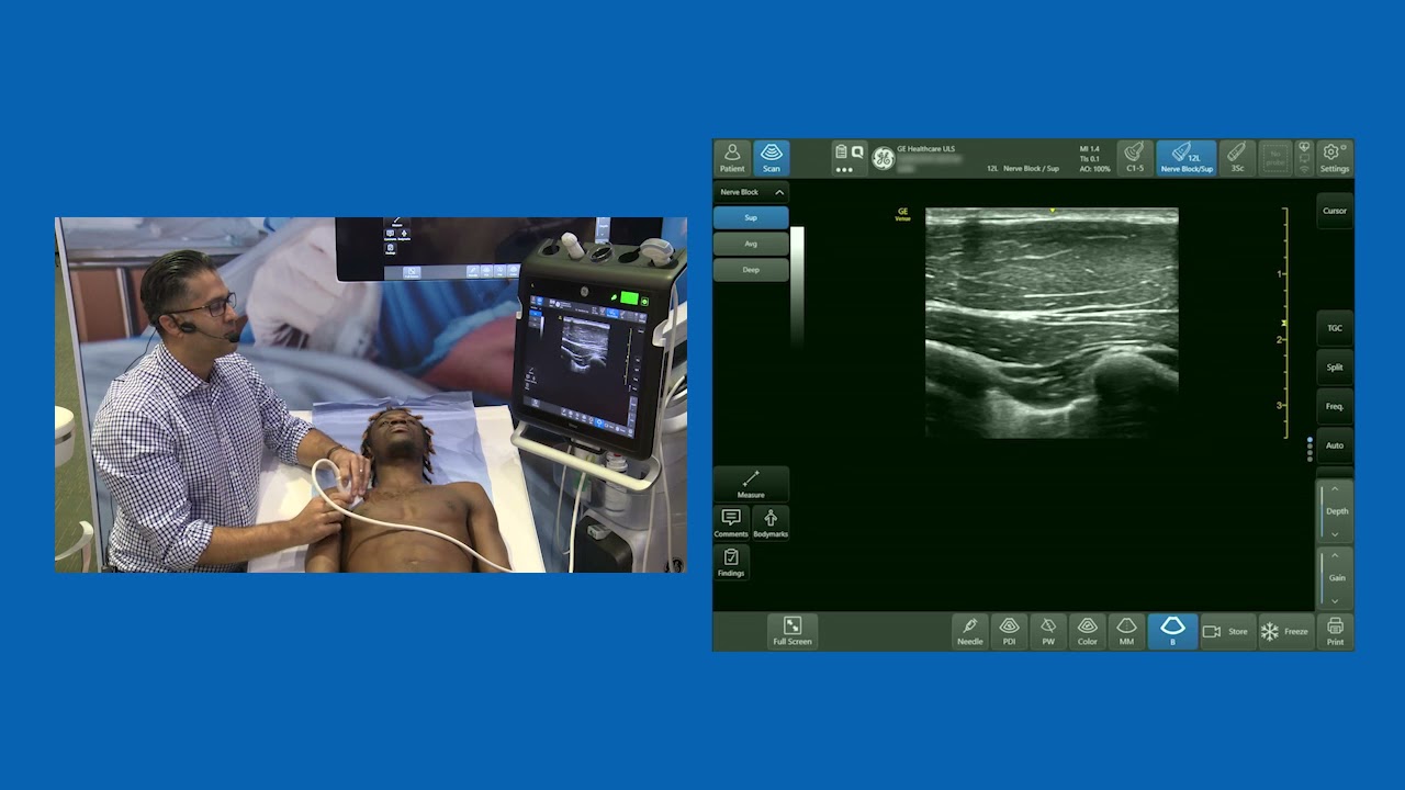 PECS 2 or PectoSerratus Plane Block