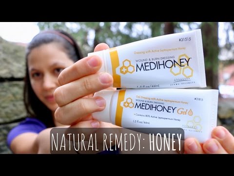 Honey Heals Wounds, Burns & Even MRSA? | My Review of MEDIHONEY