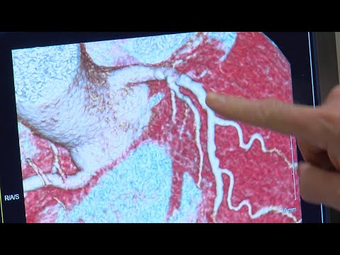 Researchers say nearly 70% of women don't know heart disease No. 1 killer of women