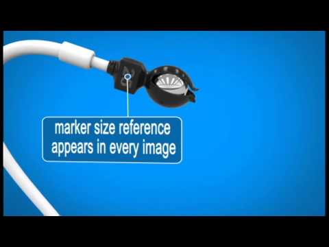 What is X-Ray Magnification and How to Combat It