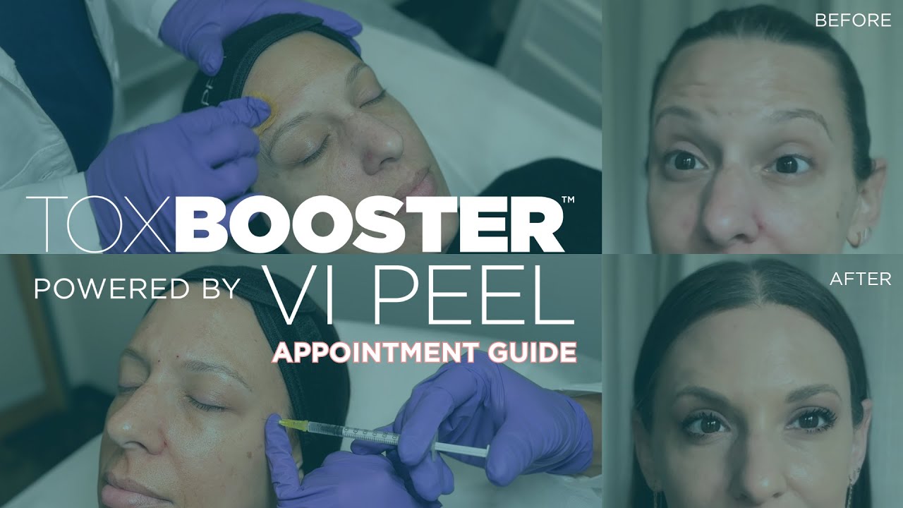 ToxBooster Appointment Guide