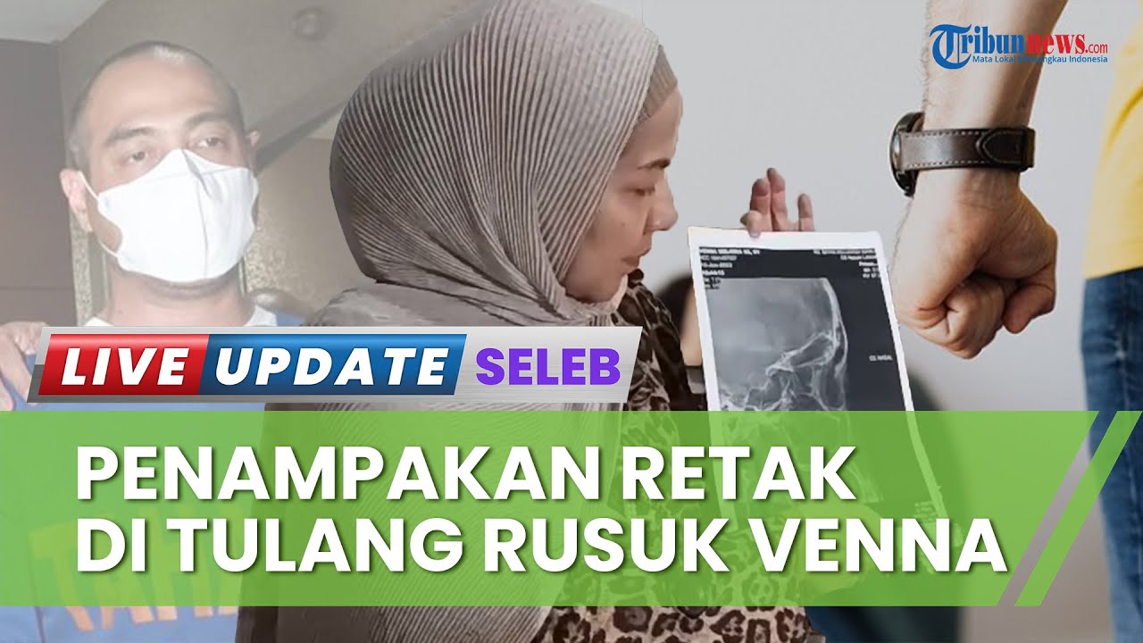 Penampakan Retak pada Tulang Rusuk Venna Melinda dan Pembuluh Darah Hidung yang Pecah - Tribun Video