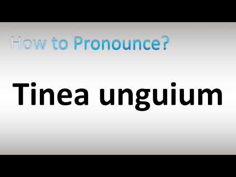 How to Pronounce Tinea unguium