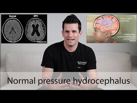 Normal Pressure Hydrocephalus \\ everything you need to know