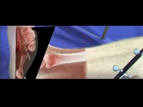 CAMP: Advanced Medical Imaging and Visualization Technology