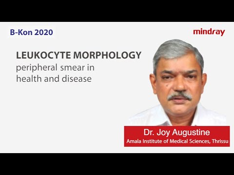 Leukocyte morphology in peripheral smear in health and disease | Dr. Joy Augustine