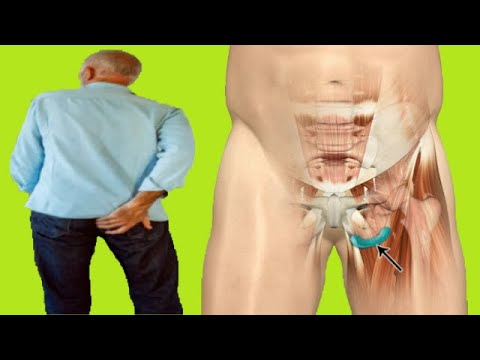 Ischial Bursitis: Symptoms And Treatment