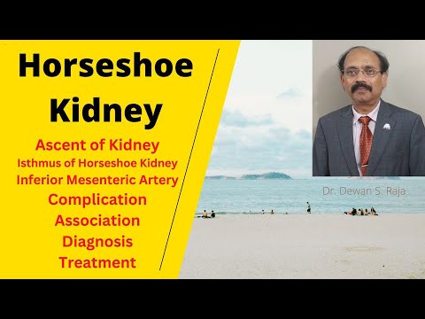 Horseshoe Kidney