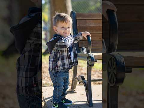 Baby with spina bifida has promising future after fetal surgery with stem cells