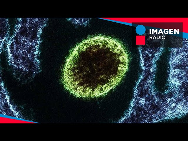 ¿Qué es y de dónde viene el virus Langya? | Bien y Saludable | IMAGEN RADIO