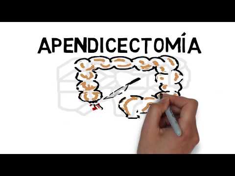 Spanish Medical Interpreter - Spanish Medical Terminology-How to Pronounce Appendectomy in Spanish ?