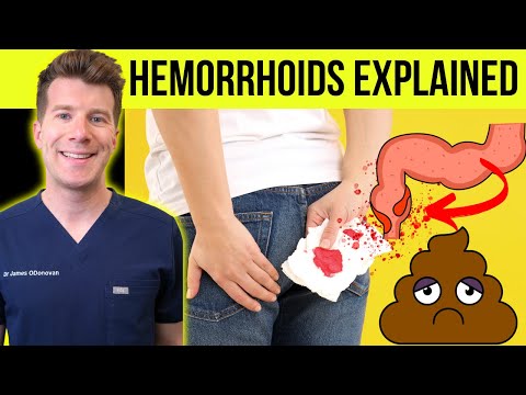 Doctor explains HEMORRHOIDS (aka piles) | Causes, symptoms, treatment & prevention