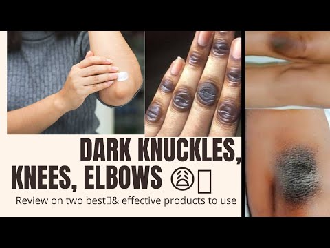 Dark Knuckles / Dark Knees / Dark Elbow / Products and Maintenance