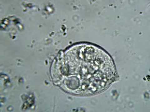 Microscopio: Agua estancada a través del microscopio