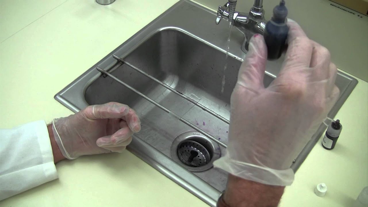 Acid-Fast Staining of Sputum Sample