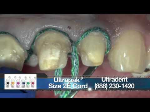 Replacing Crowns on Teeth #7-10 With BruxZir® Anterior