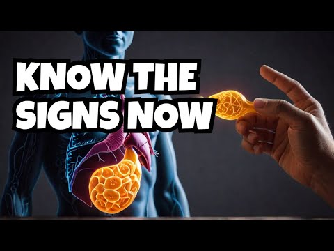 Pancreatic Cysts & Pseudocysts – What You NEED To Know Before It's Too Late!