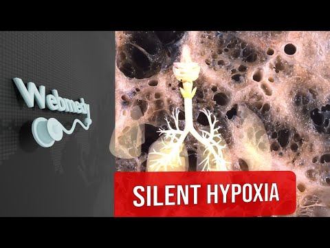 Why Happy Hypoxia is Silent Killer in COVID?