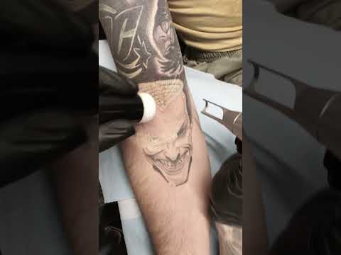 Laser tattoo removal - before and after progress #shorts #beforeandafter #lasertattooremoval