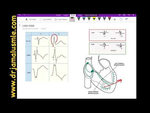 LBBB and RBBB (left VS right bundle branch block)- Dr Jamal USMLE - Cardiology ECG lecture