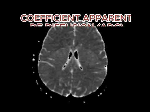 SEQUENCES IRM #radiologystudent #hospital