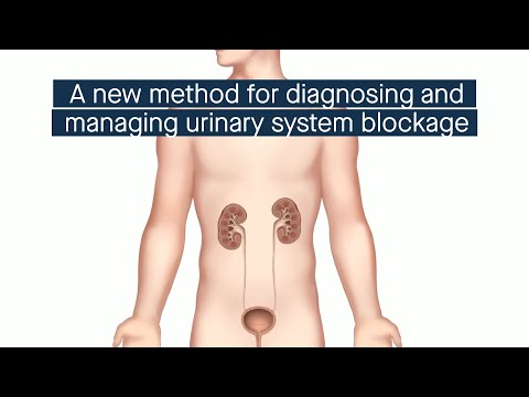 DRS using a CZT SPECT/CT camera can improve urinary system blockage diagnosis