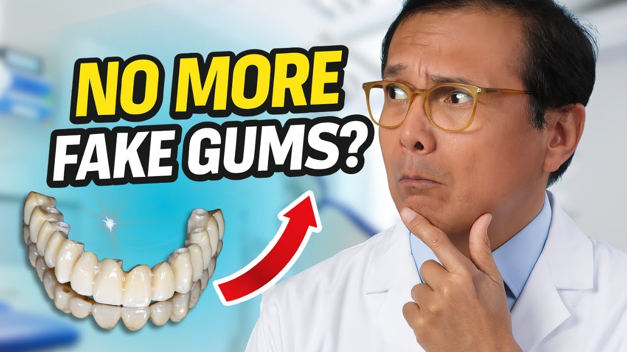FP1 Full Arch Dental Implants – Natural-Looking Teeth Without Fake Gums