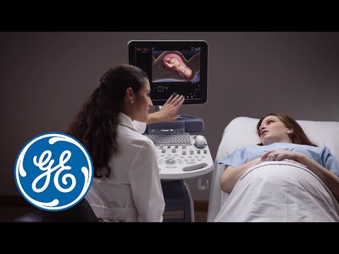 GE Ultrasound Machine - GE Voluson P8 3D Ultrasound Machine Wholesaler ...