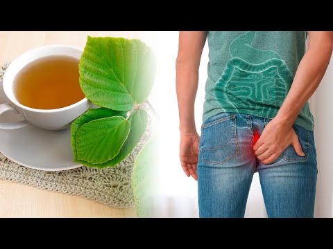 The Amazing Benefits of Witch Hazel To Treat Hemorrhoids, Varicose Veins and More