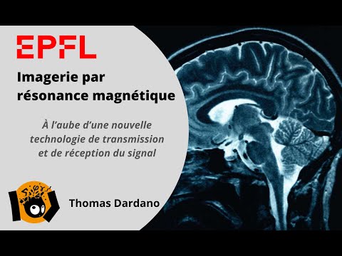 Séminaire physique - Imagerie par résonance magnétique - Thomas Dardano
