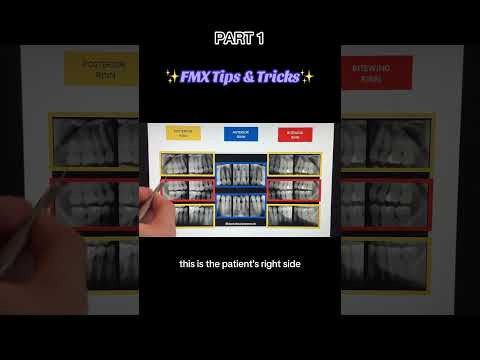 How to read the FMX- Full Mouth XRays. #teeth #dentalassistant