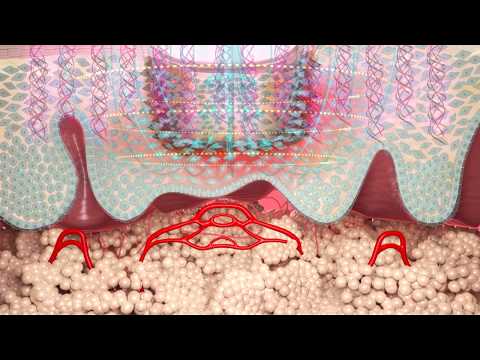 Piomic Medical - COMS® Mechanism of Action